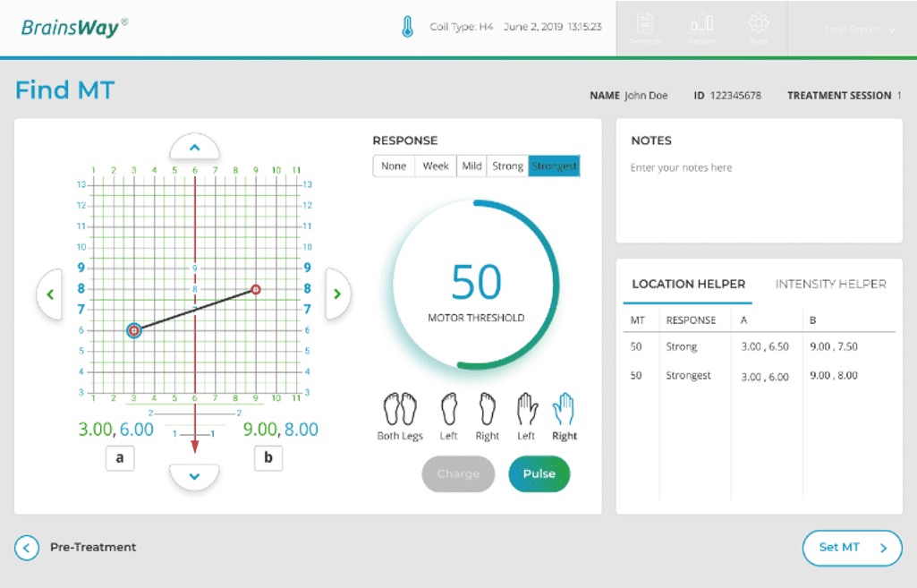 Deep TMS™ vs TMS: What Is the Difference? | BrainsWay